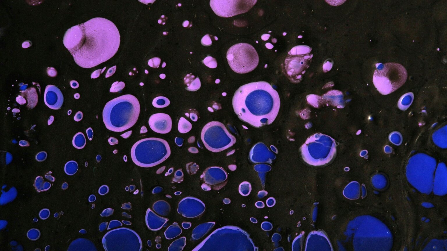 CD19標的CAR-T細胞liso-celが再発・難治性の大細胞型B細胞リンパ腫の2次治療として承認 | 国際幹細胞普及機構